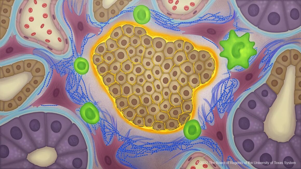 Abnormal collagen provides ‘invisibility cloak’ in pancreatic cancer ...