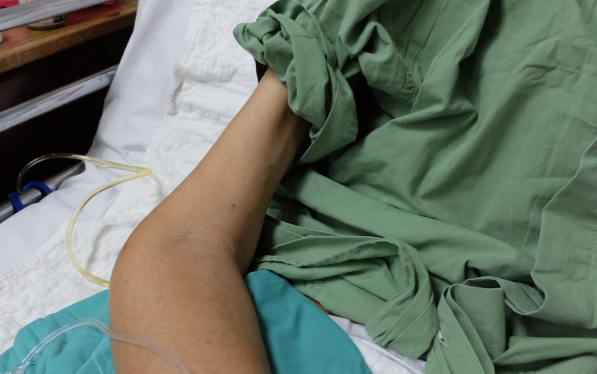 New target identified for preventing cachexia | Cancerworld Magazine