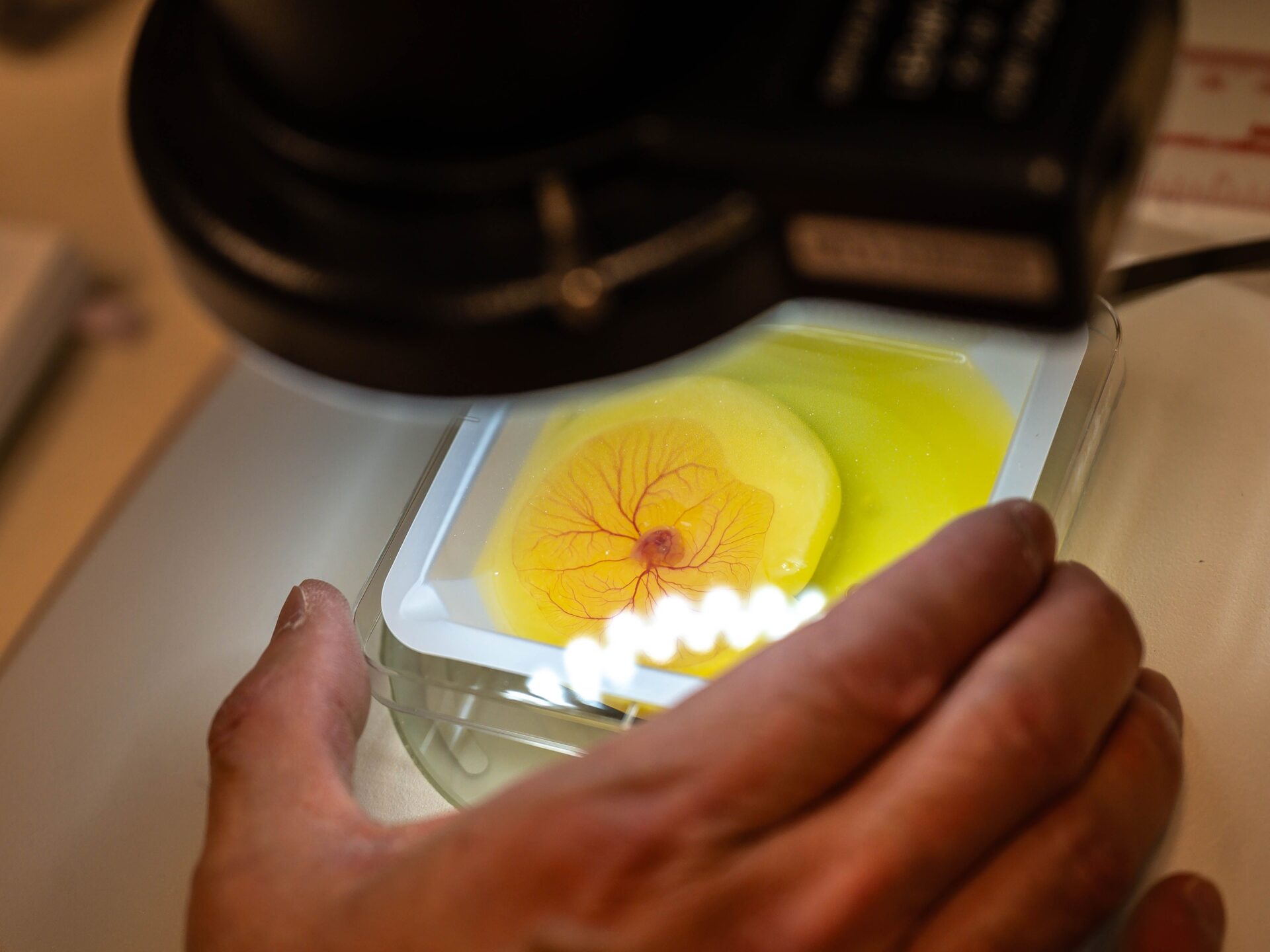 New prostate cancer blood test combining PSA with epigenetic test could ...