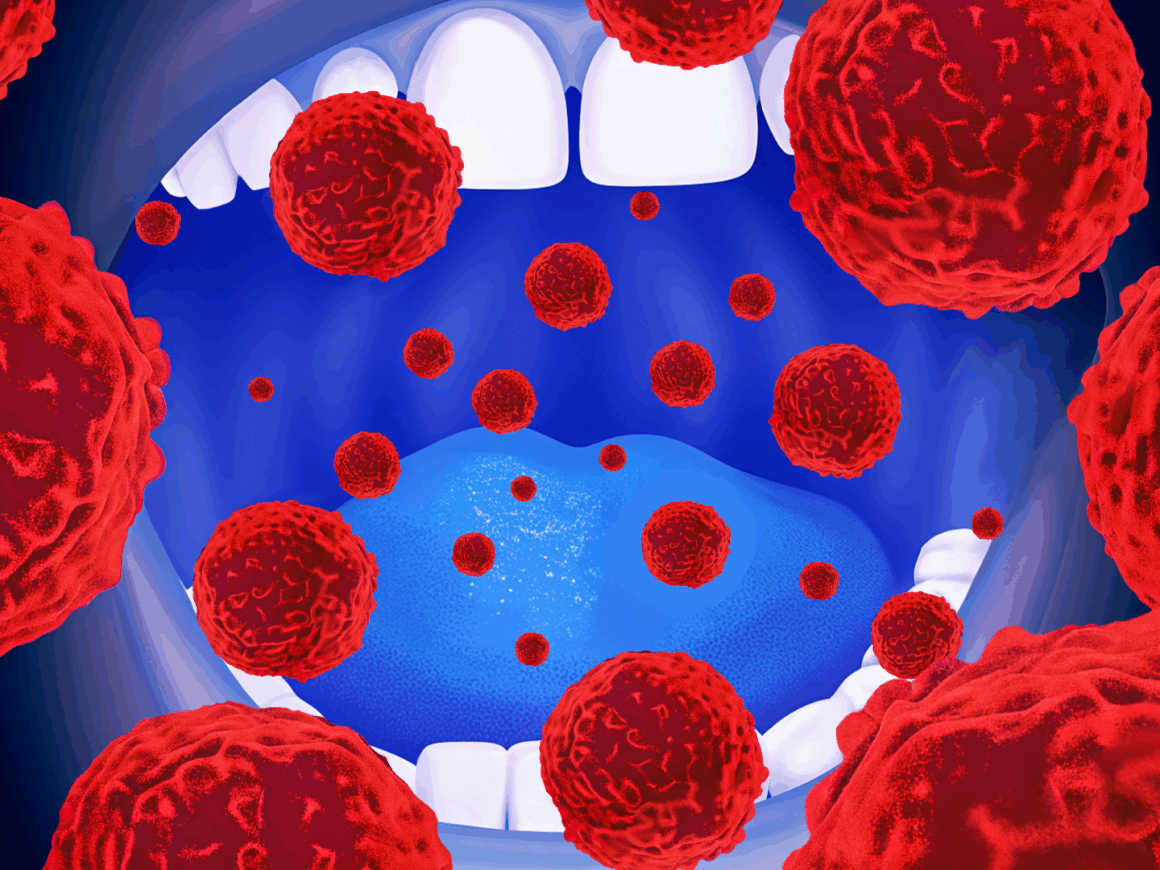 Low-dose aspirin reduces colorectal cancer recurrence in patients with ...