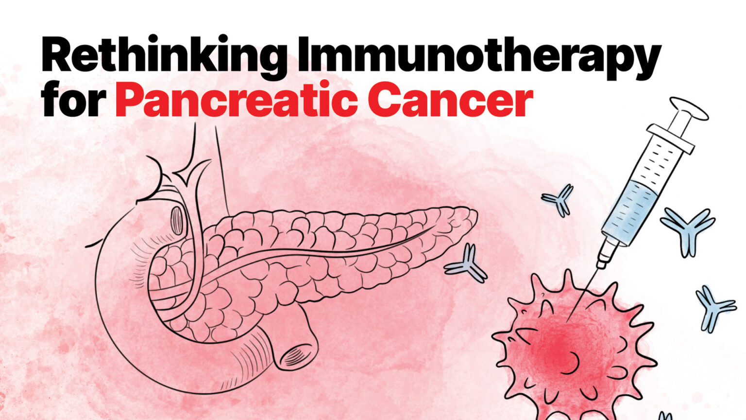 Rethinking Immunotherapy for Pancreatic Cancer: A Universal Approach ...